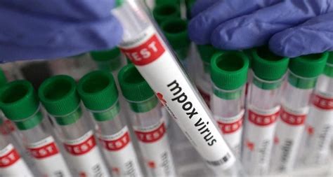 Alerta En África Por Variante Iib De Mpox Detectada En La Rdc Canal 7