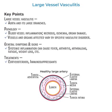 Clinical Pathology Glossary Vasculitis Large Vessels Ditki Medical