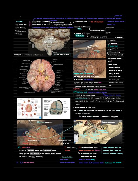 SOLUTION Cranial Nerves Studypool SOLUTION Cranial Nerves Studypool
