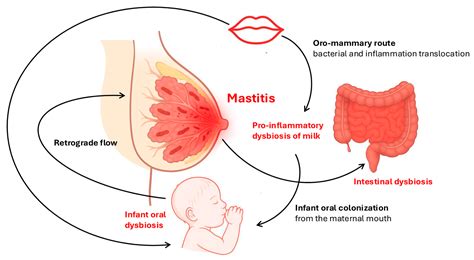 The Role Of Targeted Microbiota Therapy In The Prevention And