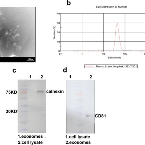 Stable Cell Selection And Characterization A Puromycin Kill Curve A