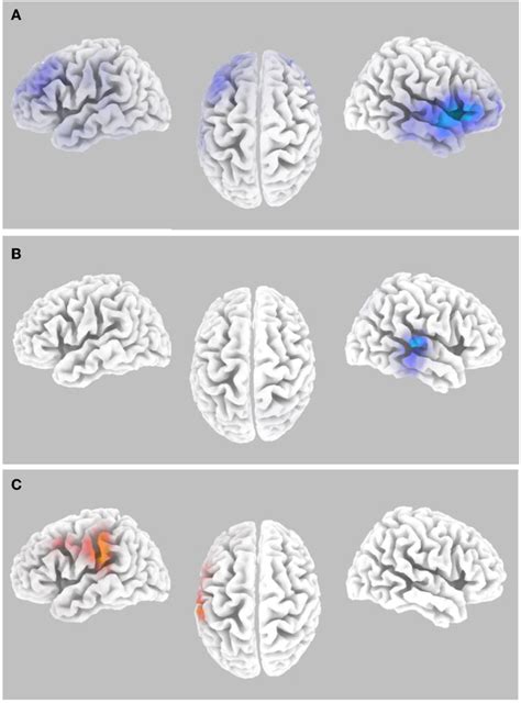Figure 1 From The Role Of Brain Localized Gamma And Alpha Oscillations In Inattentional Deafness