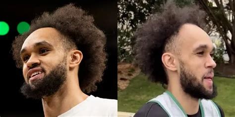 Whats Wrong With Derrick Whites Forehead Hair System