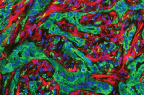 Denardo Lab Division Of Oncology Washington University In St Louis