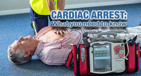 What You Should Know About Cardiac Arrest Mega Doctor News