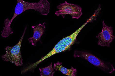 Stem Cell Treatments Become More Available And Face More Scrutiny Wsj