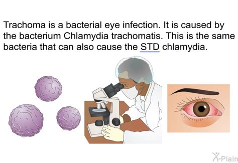 Chlamydia Trachomatis Eye Infection