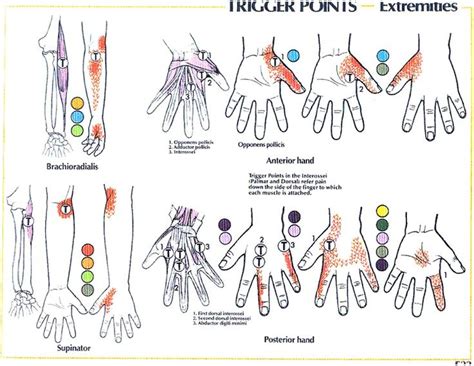 Trigger Points Arms And Hands Neuromuscular Therapy Trigger Points