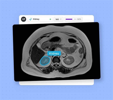 AI In Radiology Pros Cons Applications And Examples