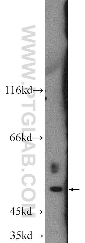 Ap1m1 Antibody 12112 1 Ap Proteintech 武汉三鹰生物技术有限公司