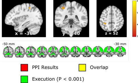 The Top Panel Shows The Ppi Results Of The 2h Diff 2h Same Contrast