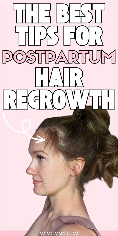 5 Shampoos For Itchy Scalp That Really Work Artofit