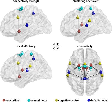 Altered Brain Maps Of CD Related Nodal Graph Metrics And Connectivity