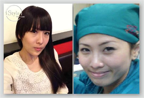 舒顏萃julie 樂芙美形診所
