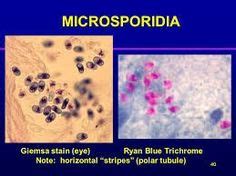 11 Microsporidia Ideas Microbiology Scanning Electron Micrograph