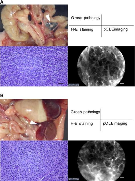 Peritoneal Metastasis Findings In The Mice Model A A Peritoneal Nodule