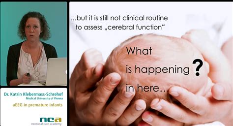 Aeeg In Premature Infants Neonatal Care Academy