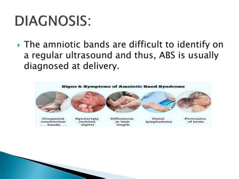 Abs Amniotic Band Syndrom Orthopediepptx