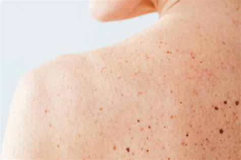 Ambulatorio Di Dermatologia Castel Maggiore Centro Medico Airam