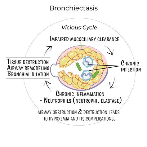 USMLE COMLEX Step 2 Glossary Bronchiectasis And Bronchiolitis For