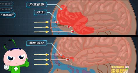 鼻涕不止？反复头痛？鼻窦炎是咋回事？鼻窦炎发病机制动漫版 知乎