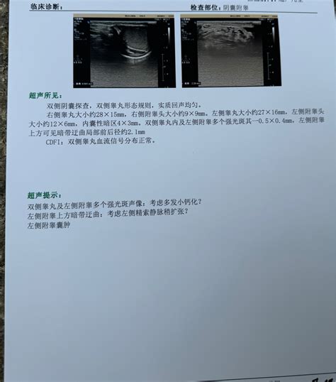 我这也是前列腺炎吗 Nga玩家社区