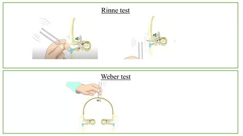 Cranial Nerve Assesment Physiotherapy Perspectivepptx