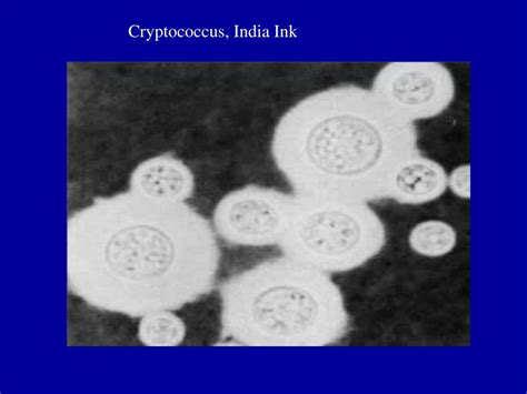 Ppt Cryptococcus Neoformans And Other Yeast Powerpoint Presentation