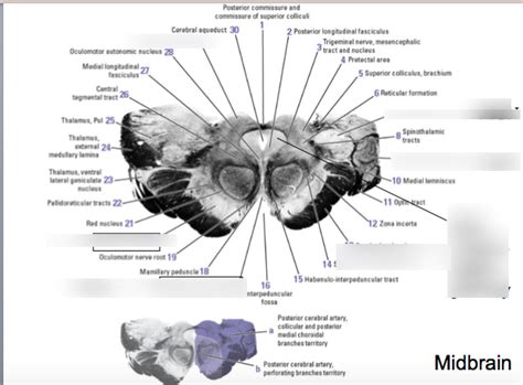Midbrain Diagram Quizlet