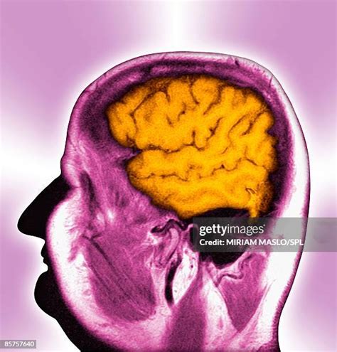 Normal Brain Scan Photos And Premium High Res Pictures Getty Images