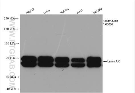 Lamin Ac Antibody 81042 1 Rr Proteintech