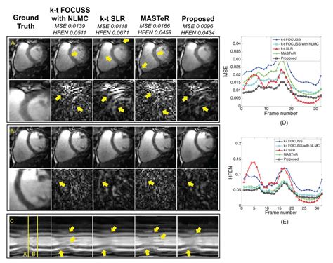 Nanoscopy Bio Imaging Signal Processing Learning BISPL