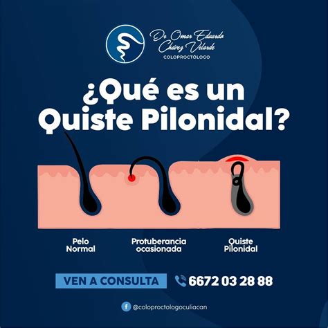 🔍 ¿qué Es Un Dr Omar Chávez Coloproctologo Culiacan