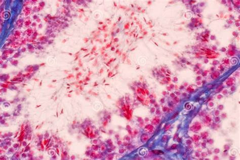Histological Epididymis And Testis Human Cells Under Microscope Stock