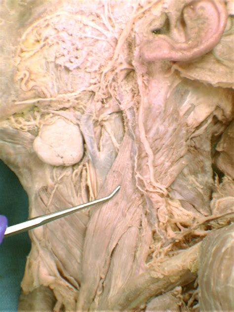 The Body Online Stony Brook University Department Of Anatomy