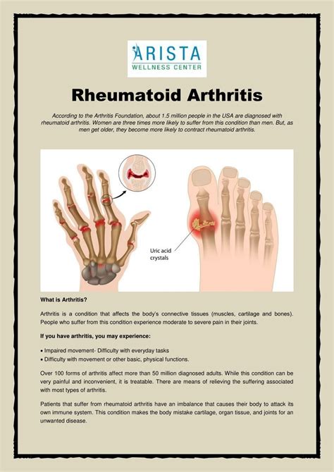 Ppt Rheumatoid Arthritis Powerpoint Presentation Free Download Id