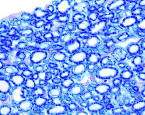 Spinal Cord Root By Jose Calvo Science Photo Library