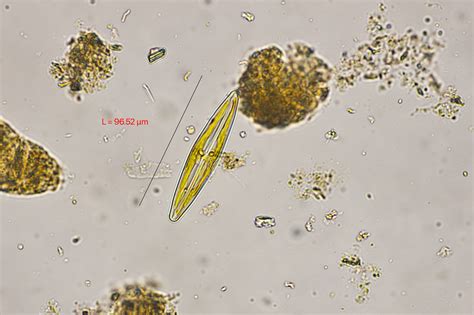 Navicula The Microscopic Life Of Shetland Lochs