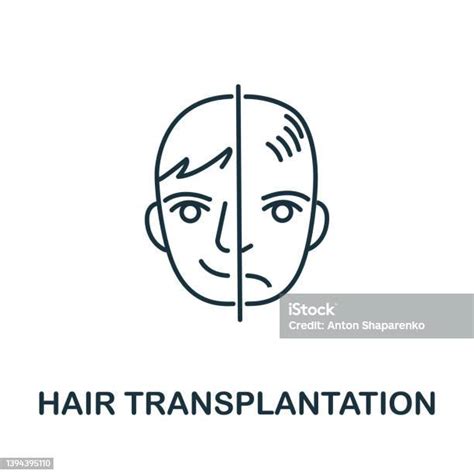 성형 수술 컬렉션에서 모발 이식 아이콘 간단한 라인 요소 템플릿 웹 디자인 및 인포 그래픽을위한 모발 이식 기호 갑상샘에 대한