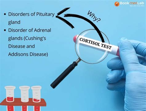 Cortisol Test Price Purpose Timing And Results 2025 • Bookmerilab