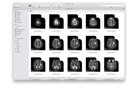 Osirix Dicom Viewer Dicom Quicklook By Osirix
