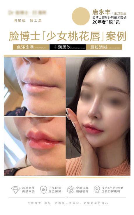 整形案例psd 设计素材和海报模板免费下载 享设计