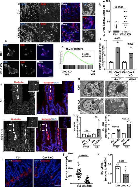 Hp1γ Controls Epithelial Proliferation And Maturation In The Small