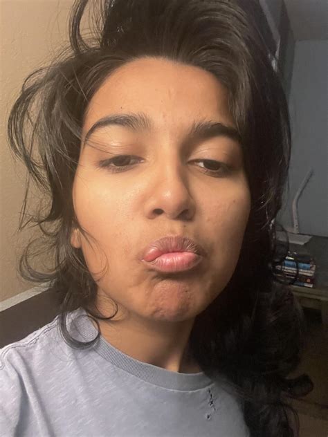 Got This Strange Bump On My Lip After Eating Spicy Stuff Rweird