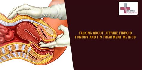 Ivf Centre In Gurgaon Thakral Nursing And Maternity Home On Tumblr