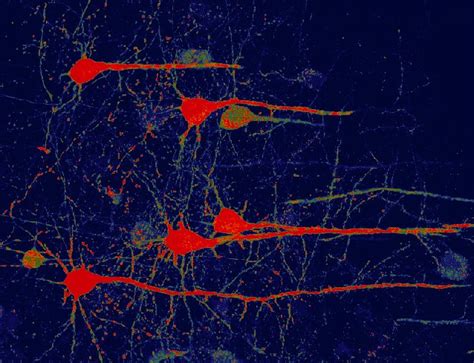 Gene Therapy Transforms Glial Cells Into Functioning Neurons
