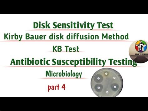 Disk Sensitivity Test Ll Kirby Bauer Disk Diffusion Method Ll KB Method