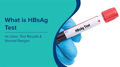 PCV Blood Test Normal Range Symptoms Result Interpretation MaxAtHome