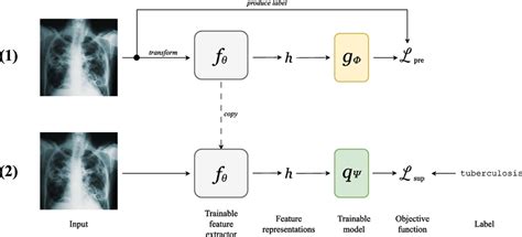 Example Of A Typical Ssl Workflow With An Application To Chest X Ray