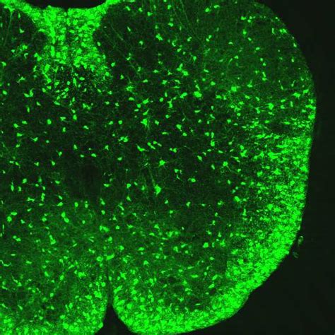 Gensat Project At Rockefeller University Mouse Brain Atlas Image